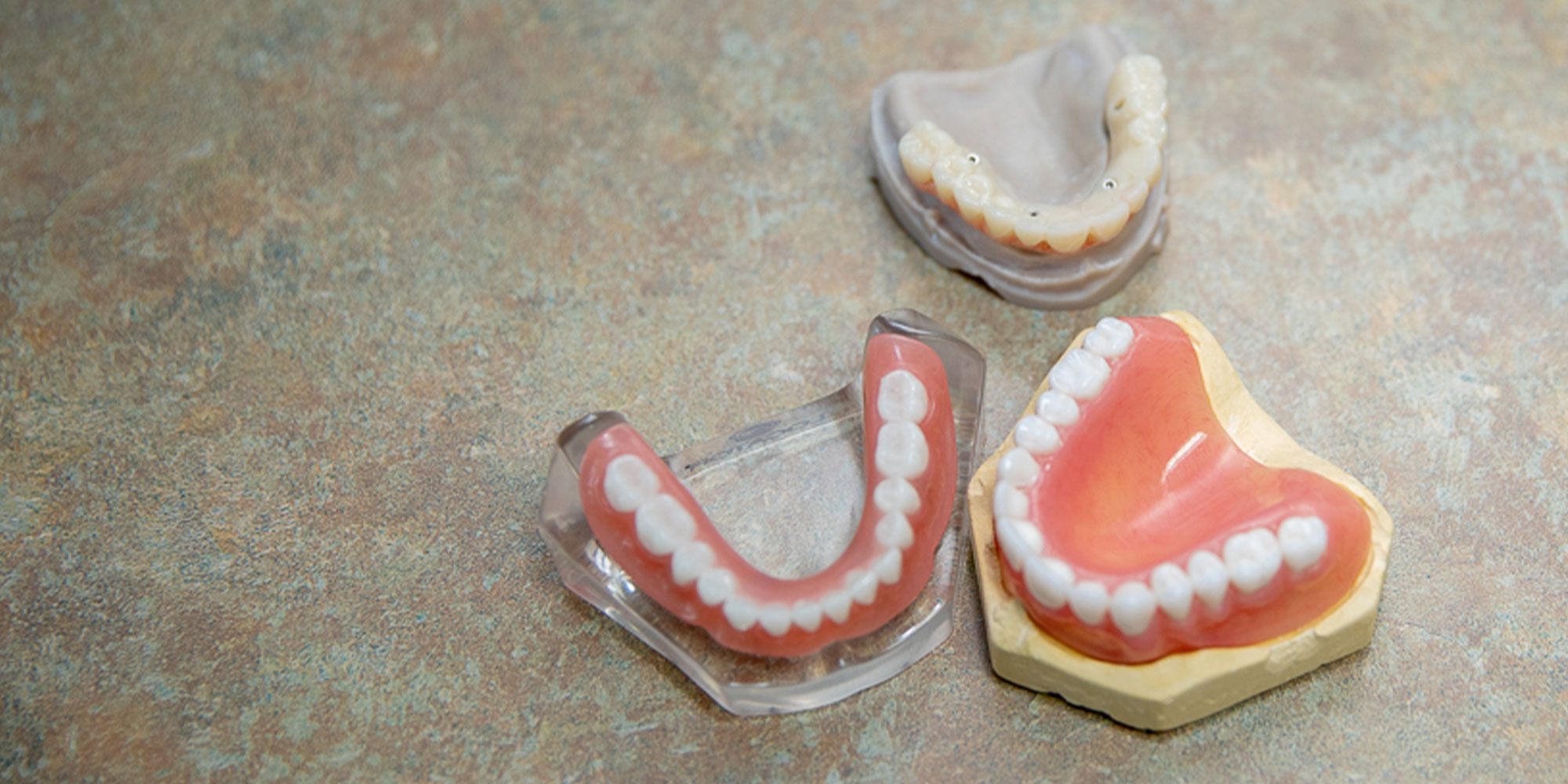 In-House Denture Lab | Argyle Advanced Dental Care | Argyle, TX